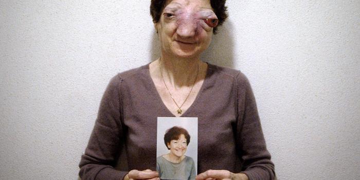 Chantal Sébire, "littéralement mangée par la douleur", réclame le droit ...