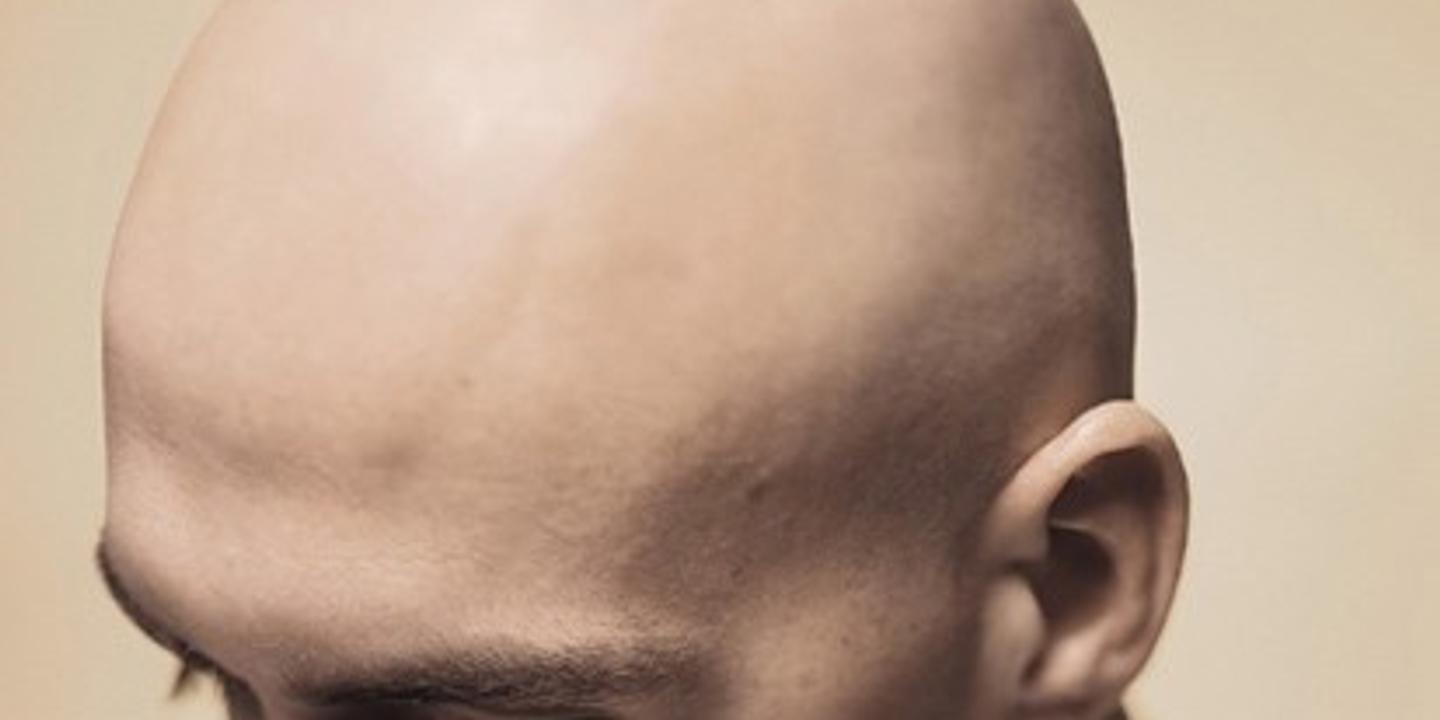 Espoir pour les chauves après la découverte d'une substance anti-stress