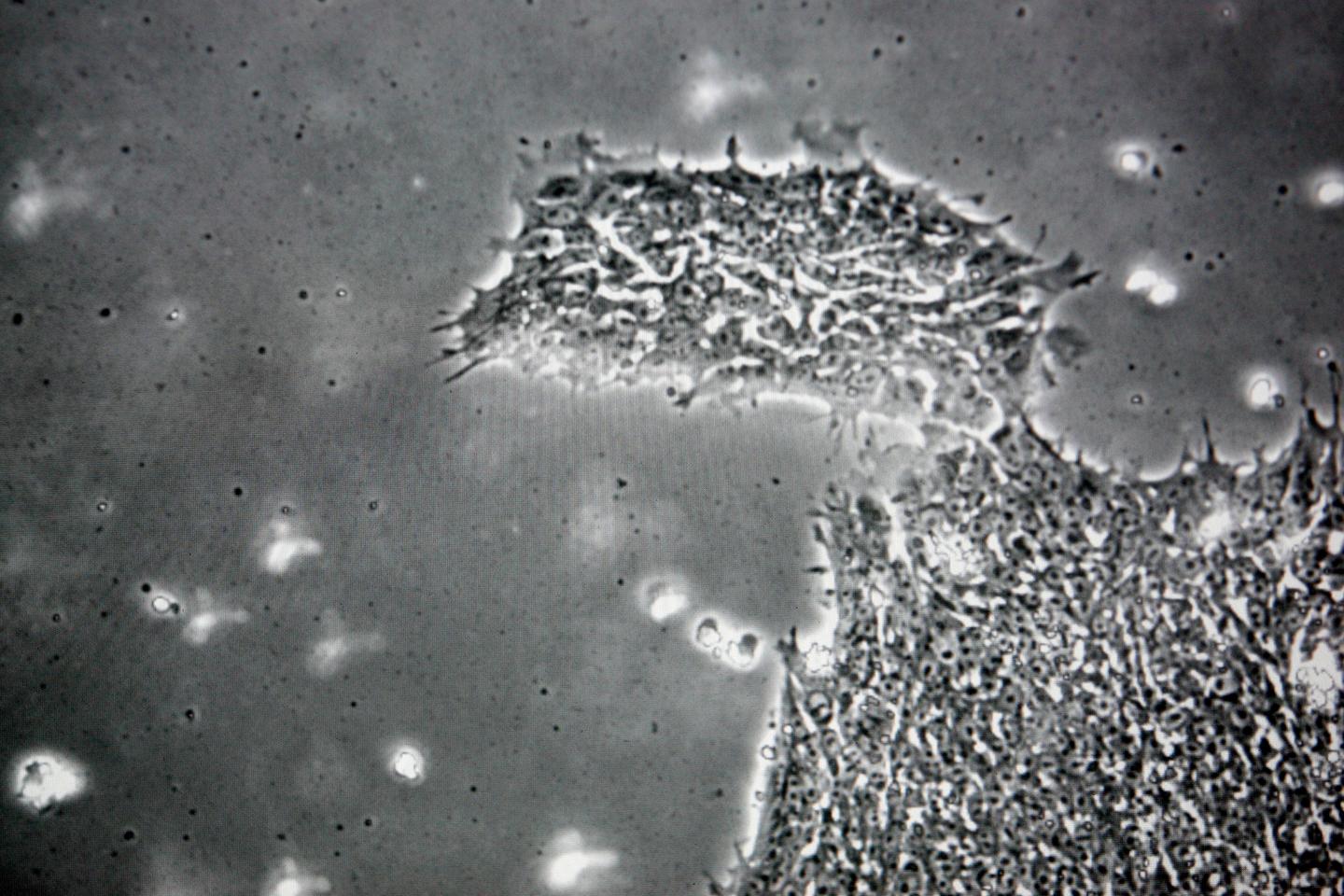Des cellules souches peuvent survivre à la mort et rester fonctionnelles