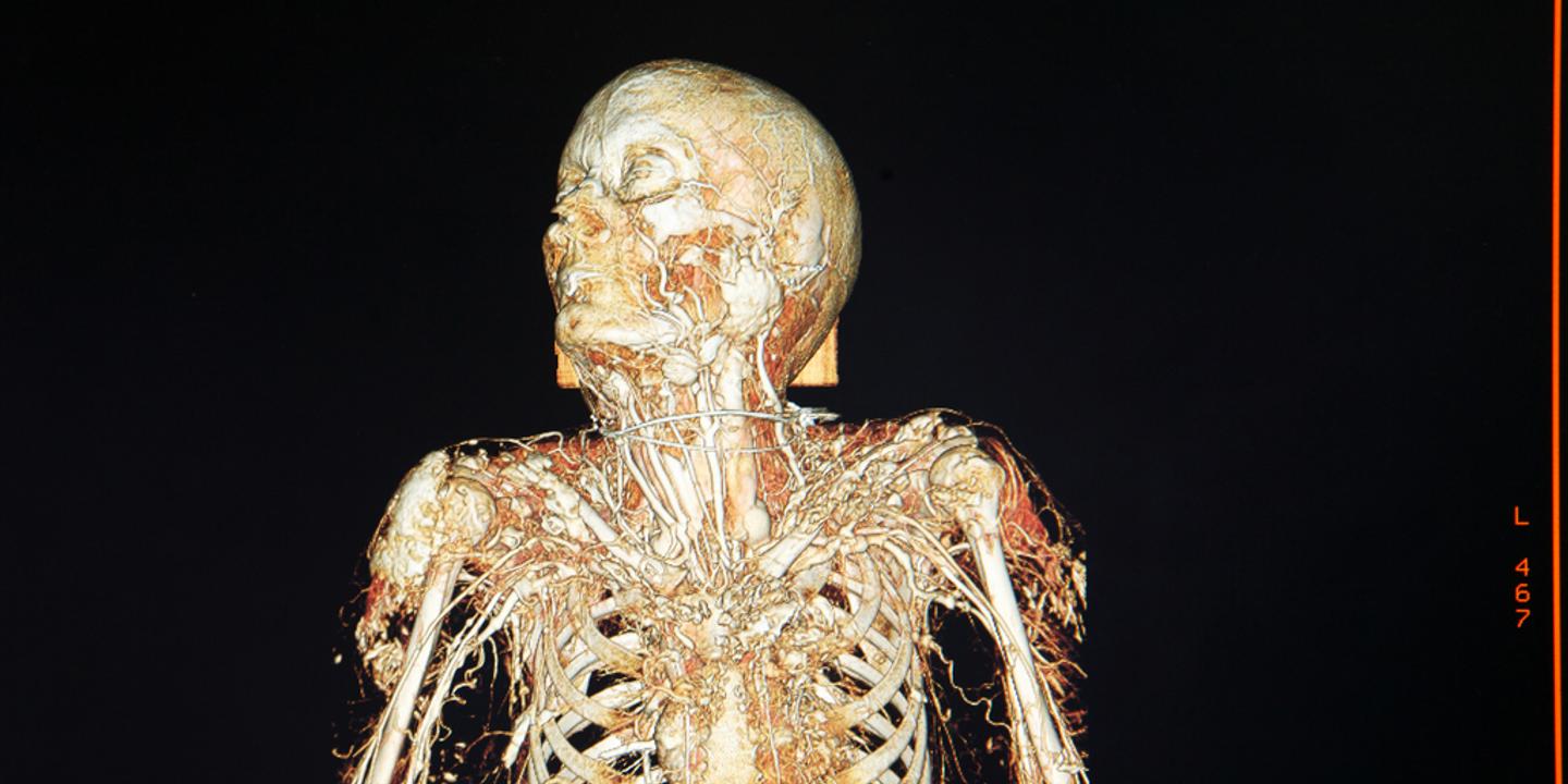 Virtopsie : du scalpel au scanner