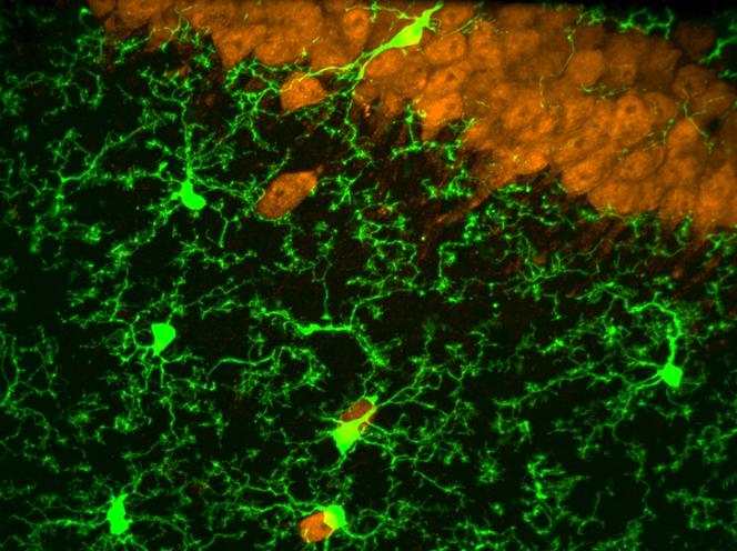 Microglie, cellule hyperactive