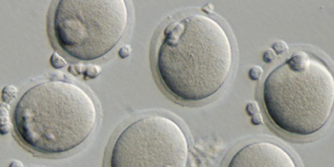 Cellules souches embryonnaires, le retour d'un débat houleux