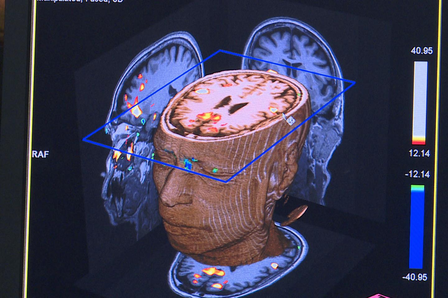 Pourquoi les incompétents se croient si doués