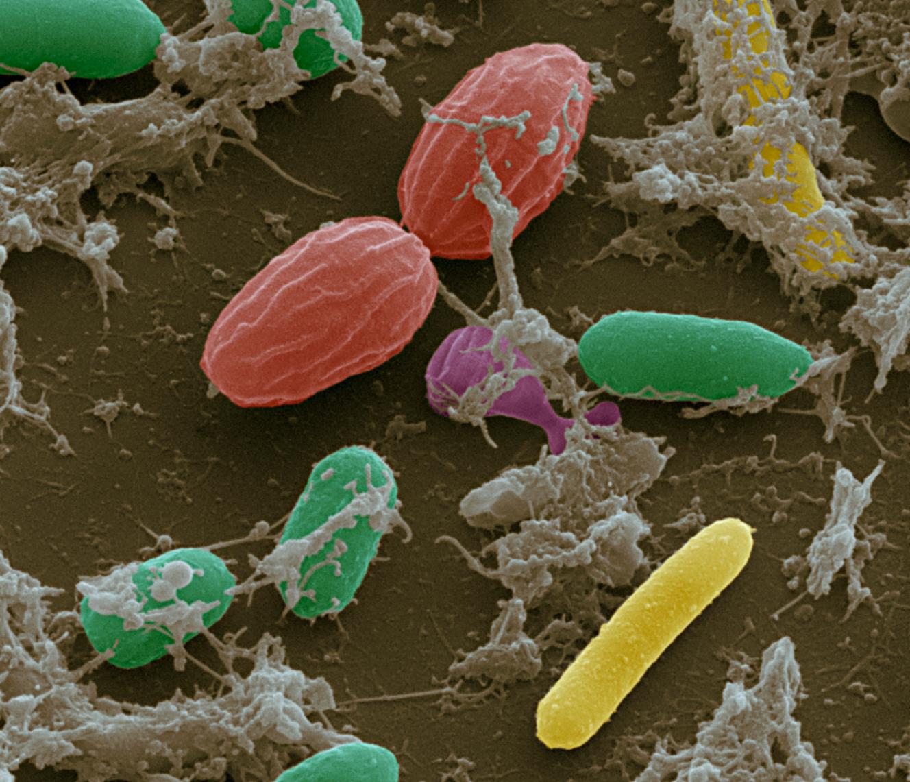 Des microbes contre les maladies cardiaques