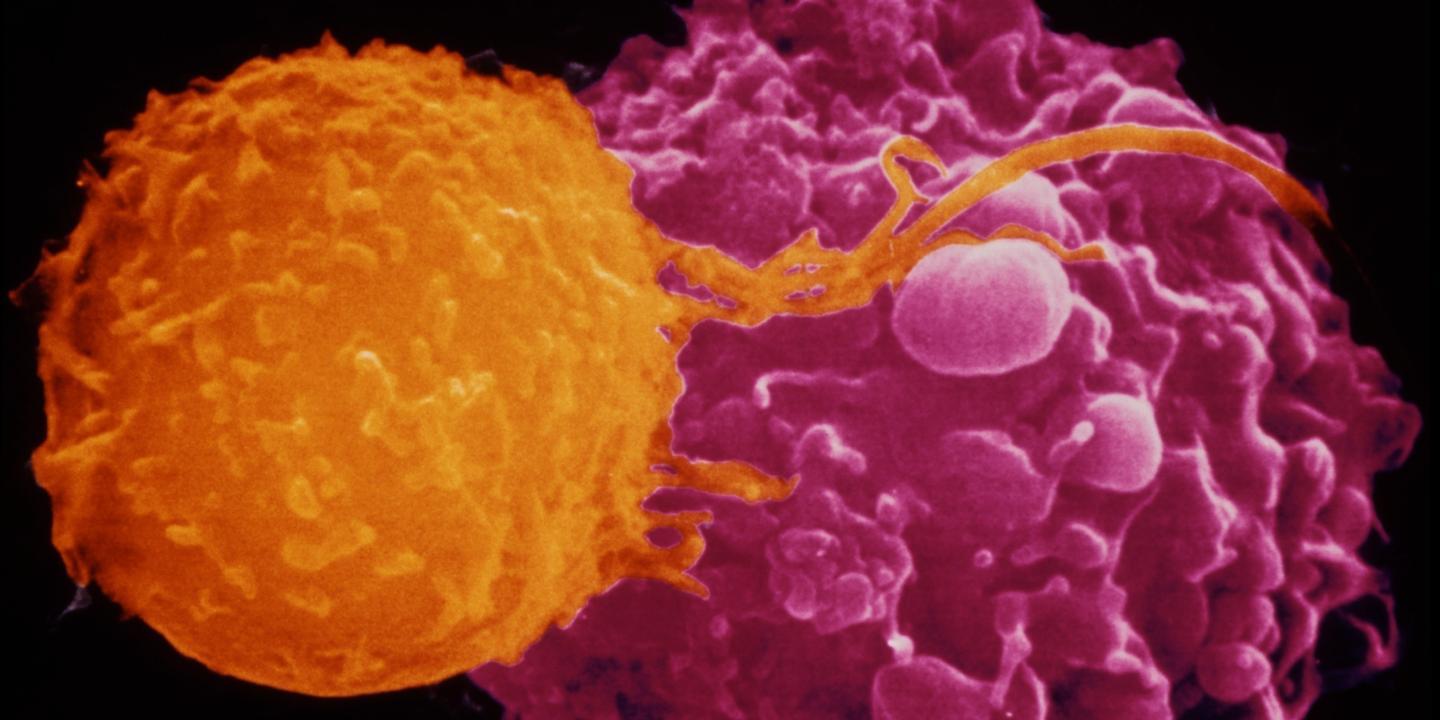 Cancer: la lame de fond des immunothérapies