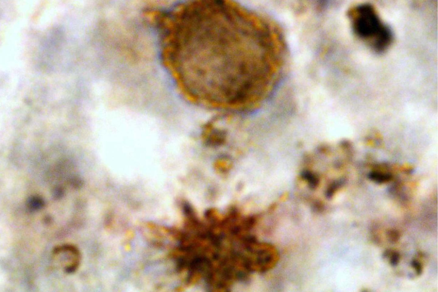 Des molécules organiques dans des microfossiles vieux de 2 milliards d ...