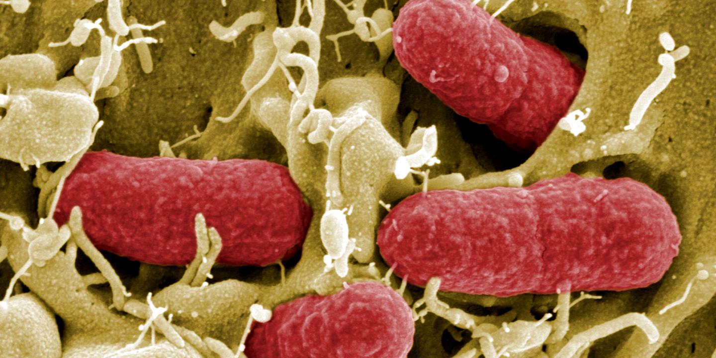 Bactérie « E. coli » : rappel massif de pizzas surgelées Buitoni, un ...