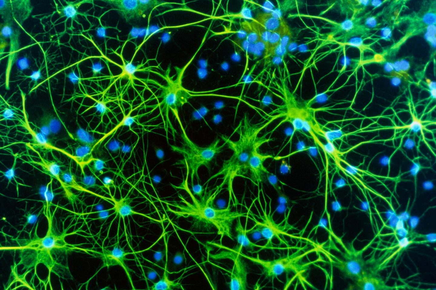 Une carte à 100 milliards (de neurones)