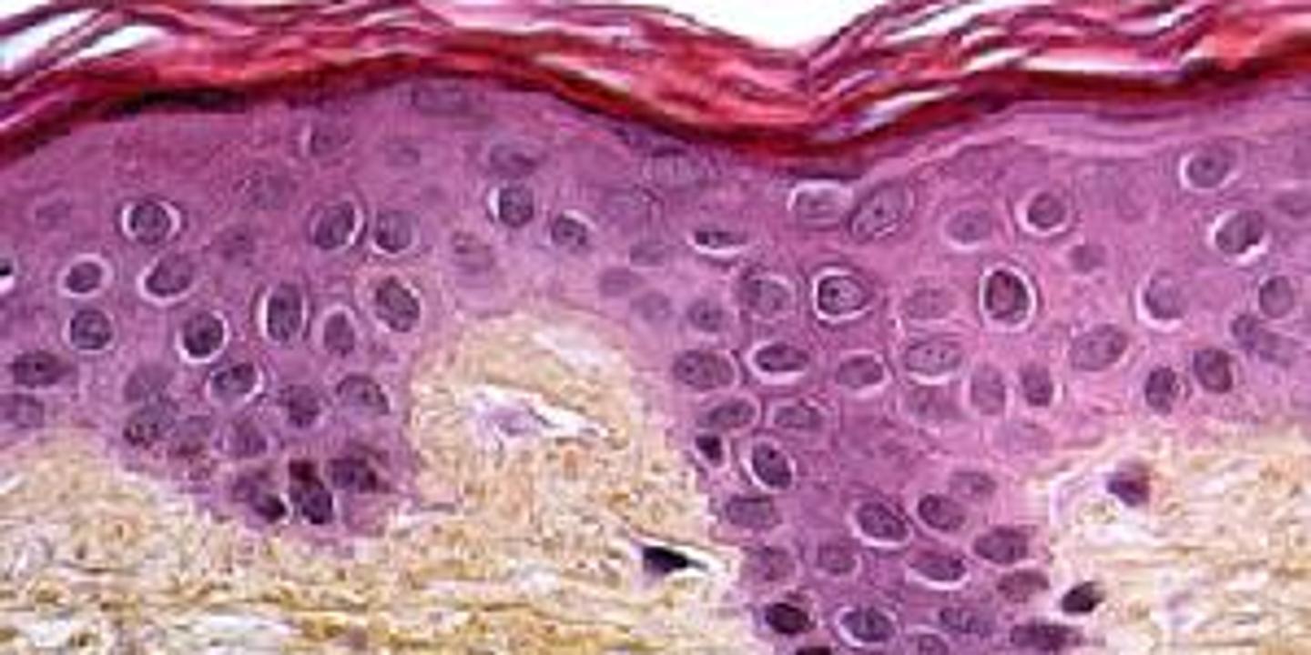 Reconstruire la peau, au plus près du réel