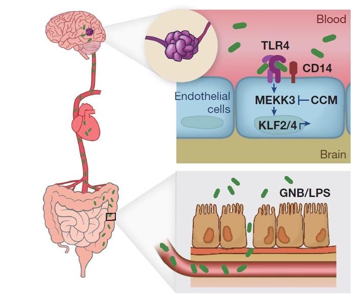 Le microbiote en cause dans des AVC