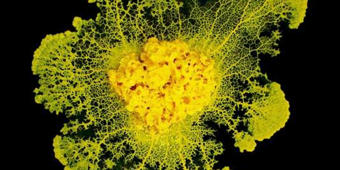 Vidéo : retrouvez toutes les réponses à vos questions sur le blob