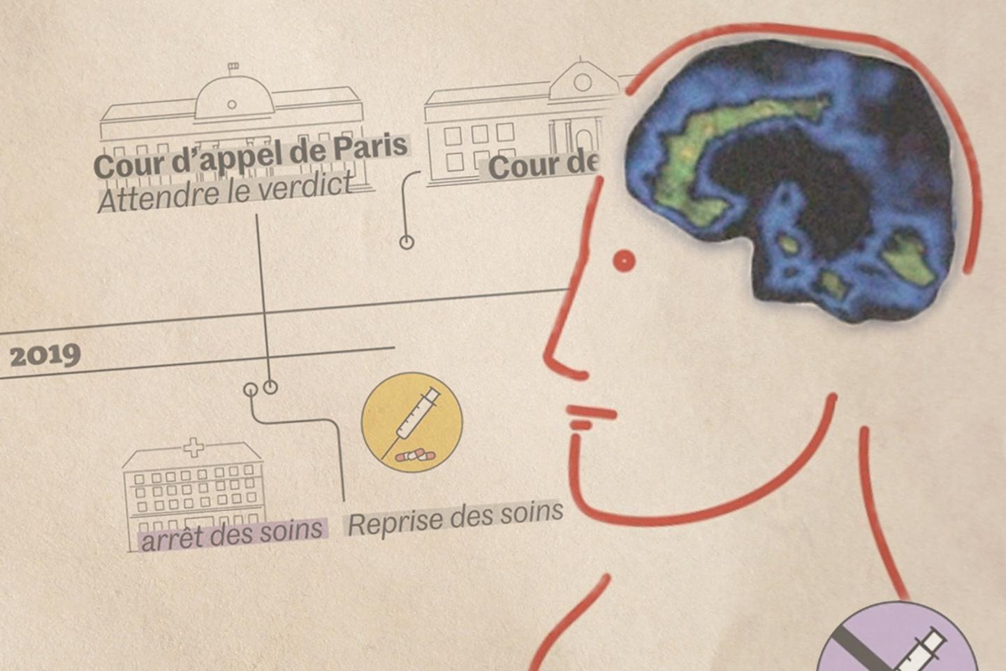 Comprendre l’affaire Vincent Lambert et ses multiples rebondissements