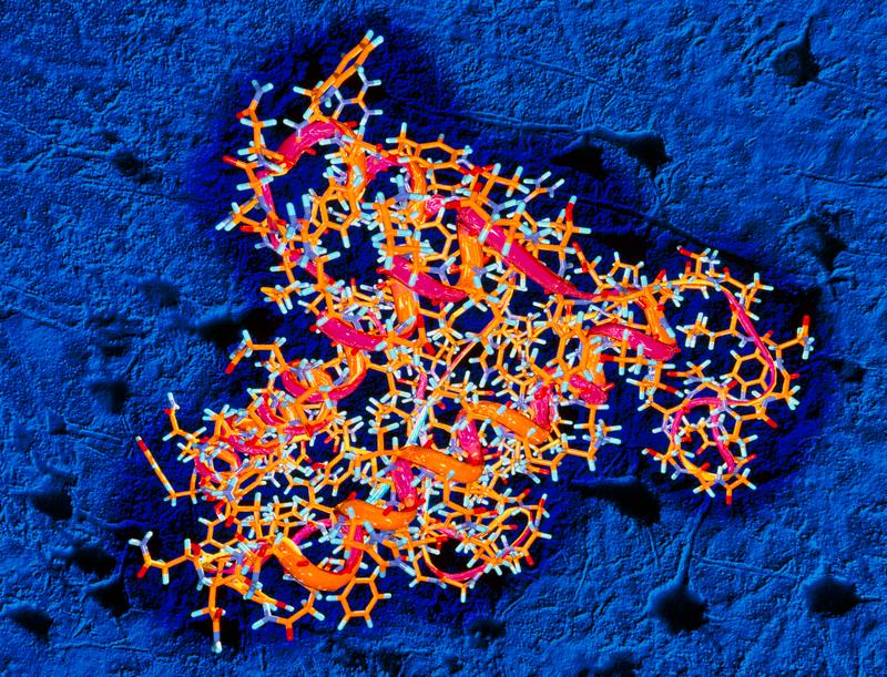 Second décès en France dans un laboratoire travaillant sur les prions