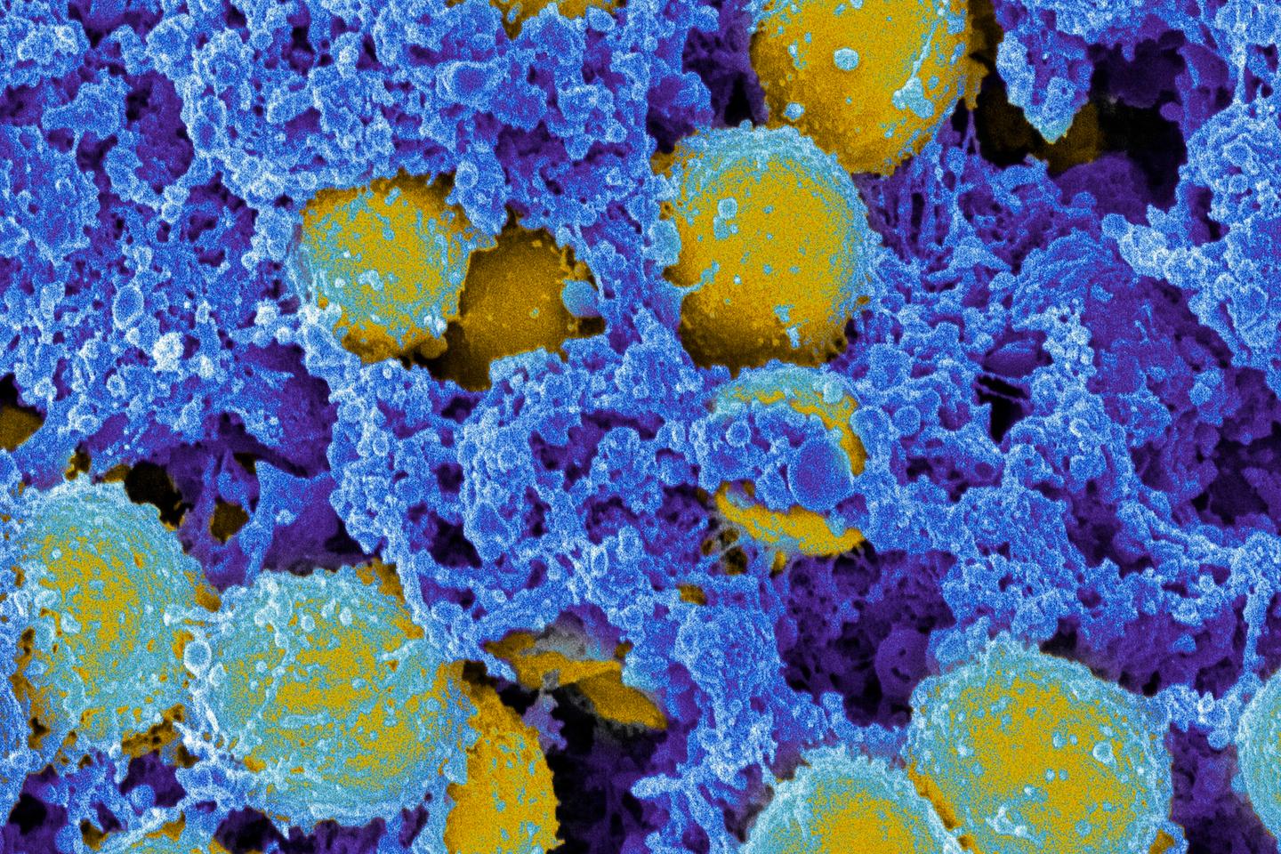 Immunité : une action rapide et spécifique contre le staphylocoque doré