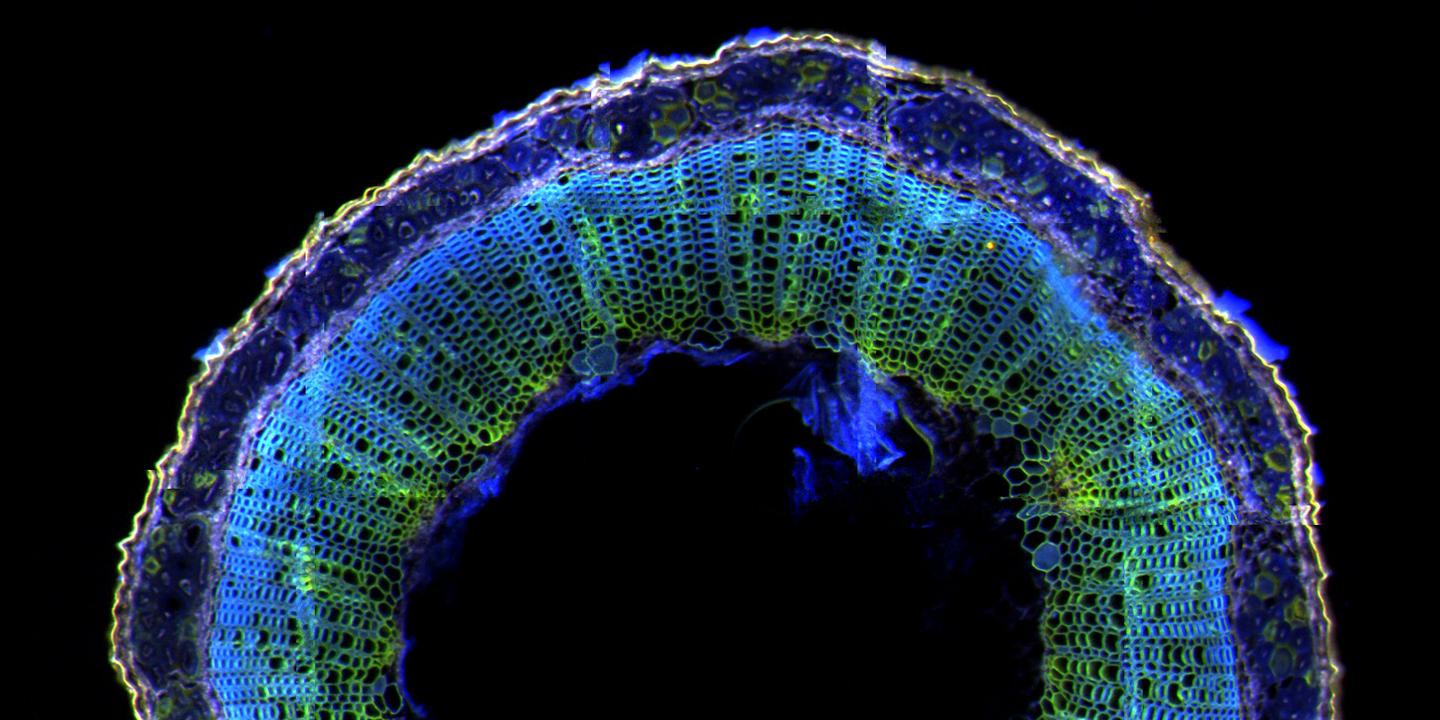 Quand l’étude des fibres anciennes éclaire les usages actuels du lin