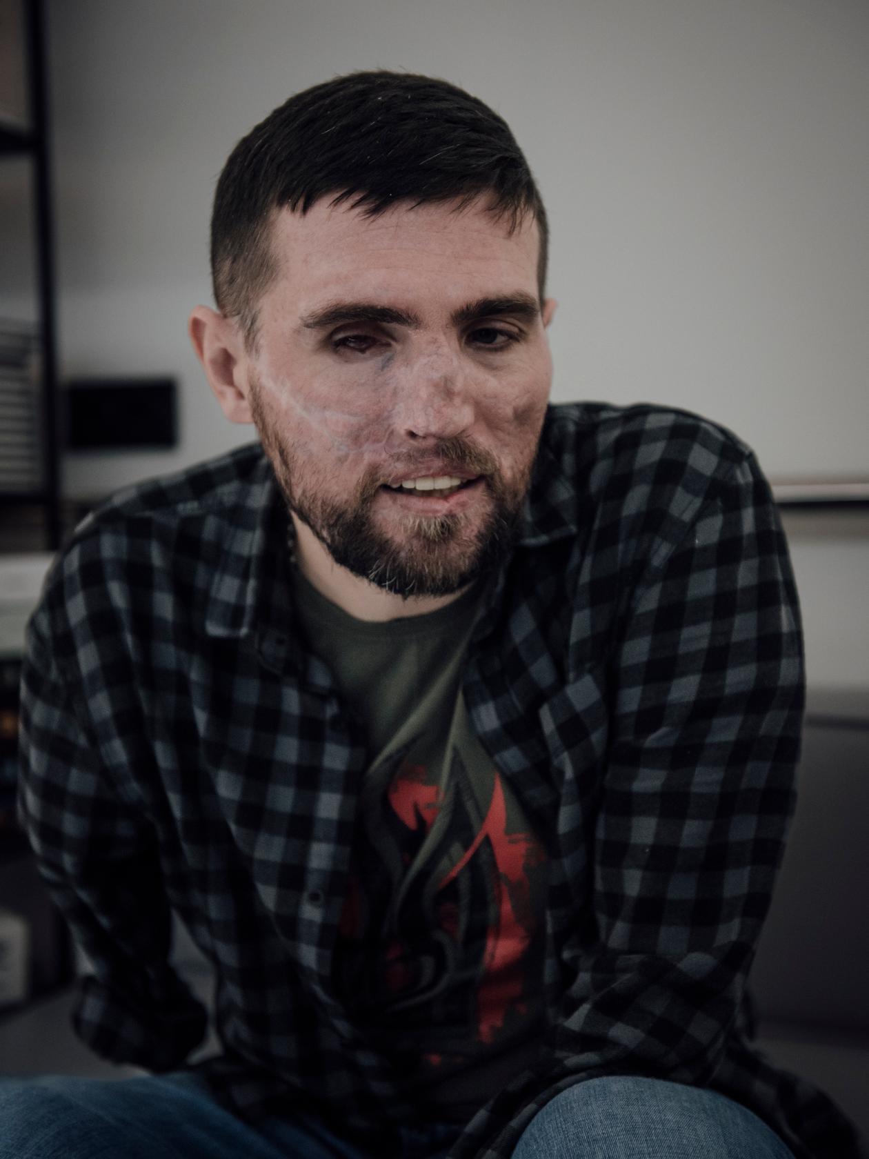 Superhumans, the center that repairs Ukraine's most gravely war-wounded