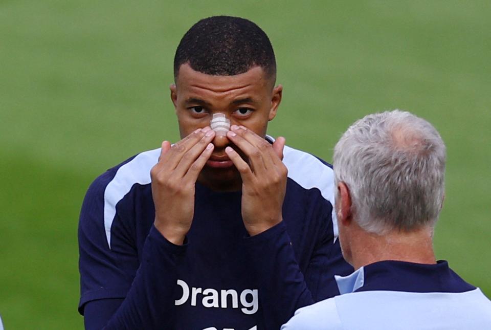 Euro 2024: Broken-nosed Mbappé partially trains ahead of Netherlands match