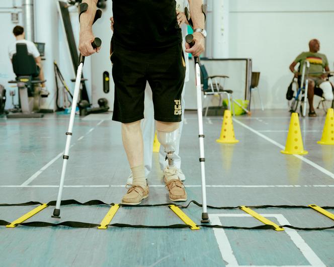 Après une amputation, il n’y a pas qu’une seule façon de s’approprier ...