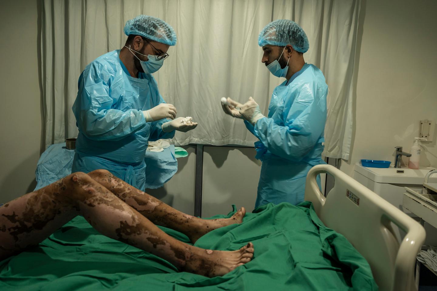 Dans l’unité des grands brûlés de l’hôpital Geitaoui de Beyrouth : « La ...