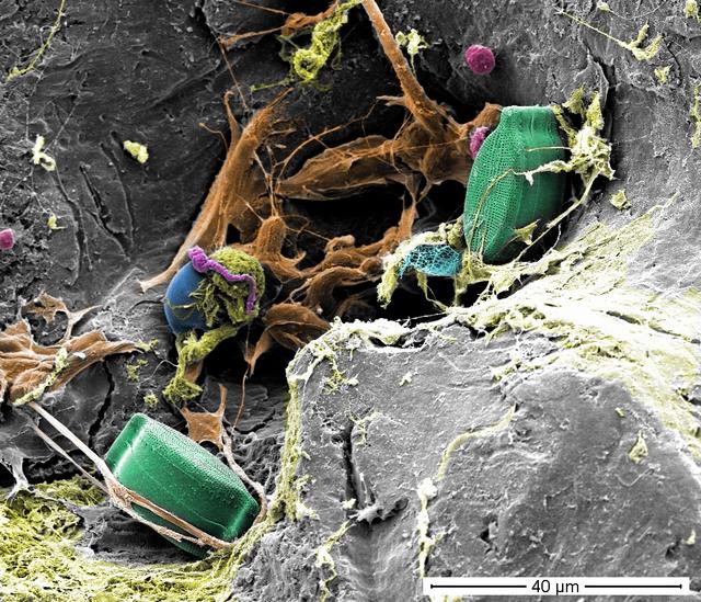 Microplastiques : une pollution invisible mais massive dans tous les fleuves européens