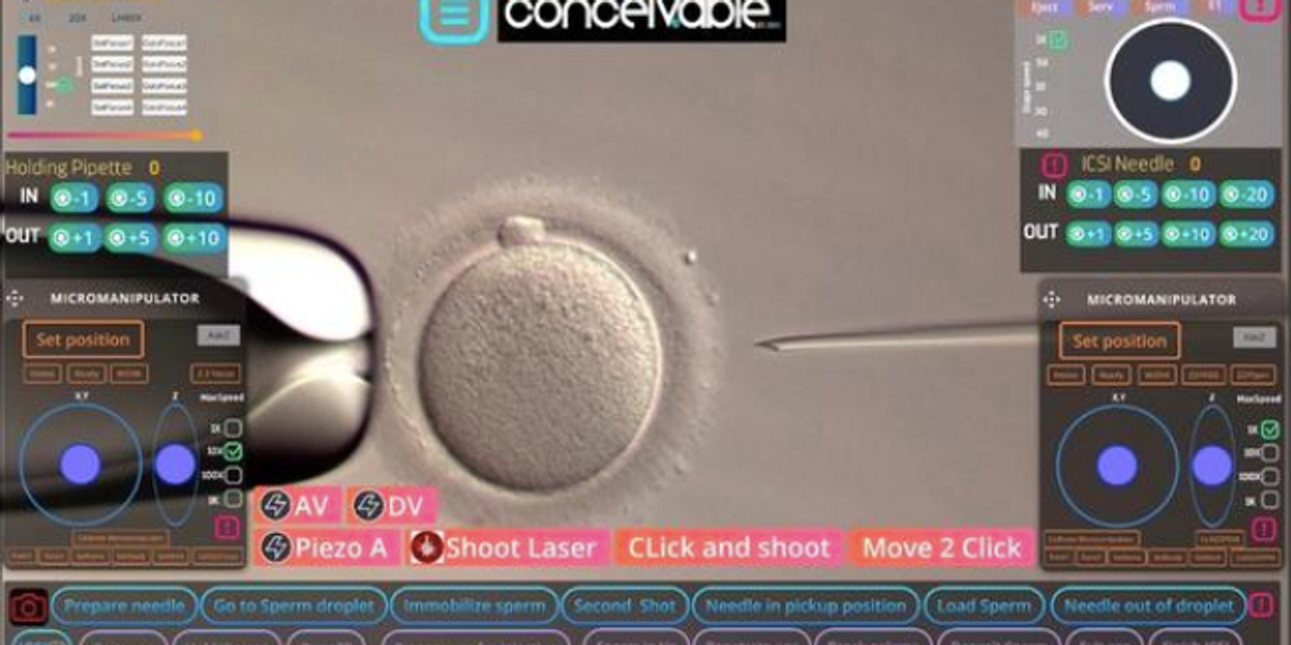 Premier bébé conçu par une FIV pilotée par l’intelligence artificielle