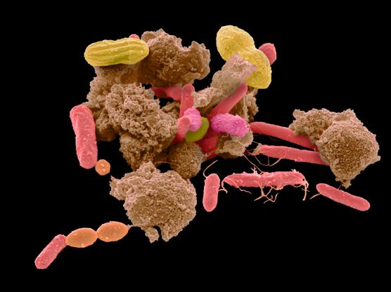 Study finds intestinal microbiota tests unreliable
