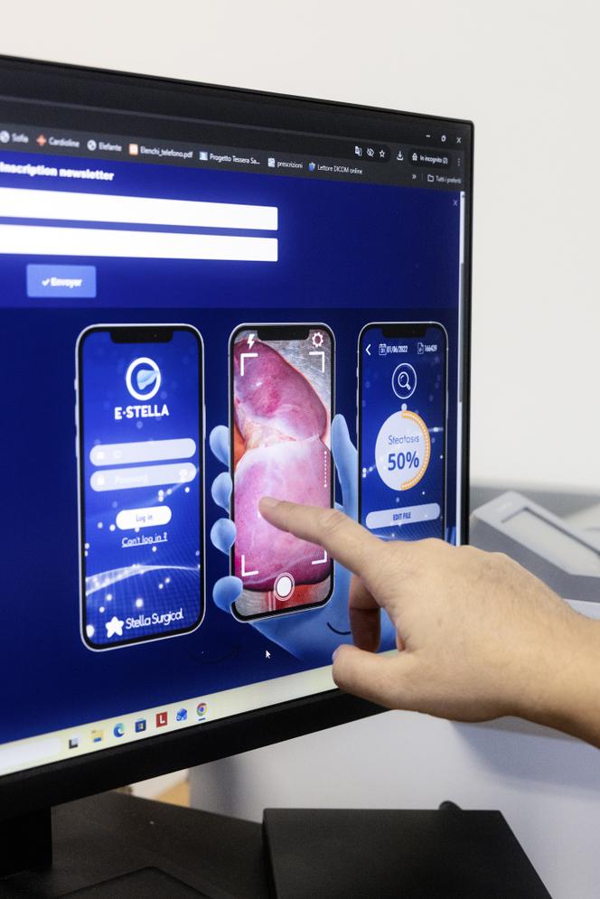 Manuela Cesaretti, pionnière de l’IA pour transformer la greffe de foie