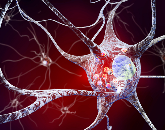 Mort de Nathalie Baye : qu’est-ce que la maladie à corps de Lewy, ce ...